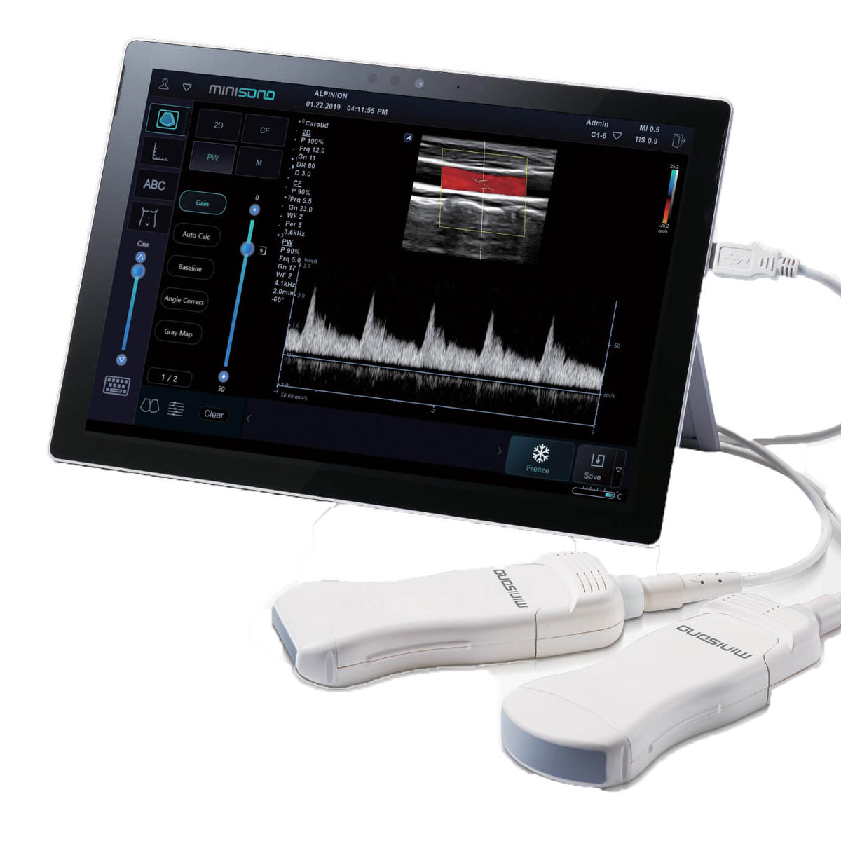 Diagnostic Ultrasound Machines Canada - Remington Medical